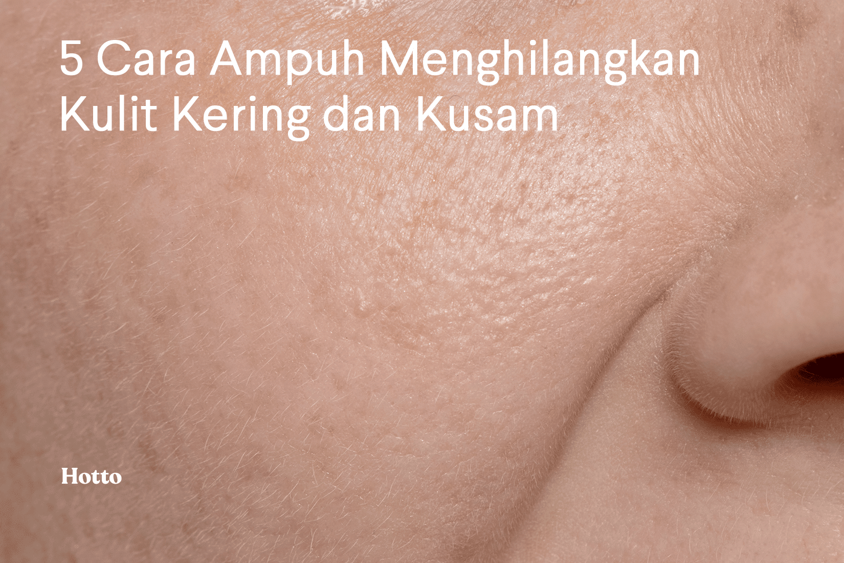 5 Cara Menghilangkan Kulit Kering Dan Kusam