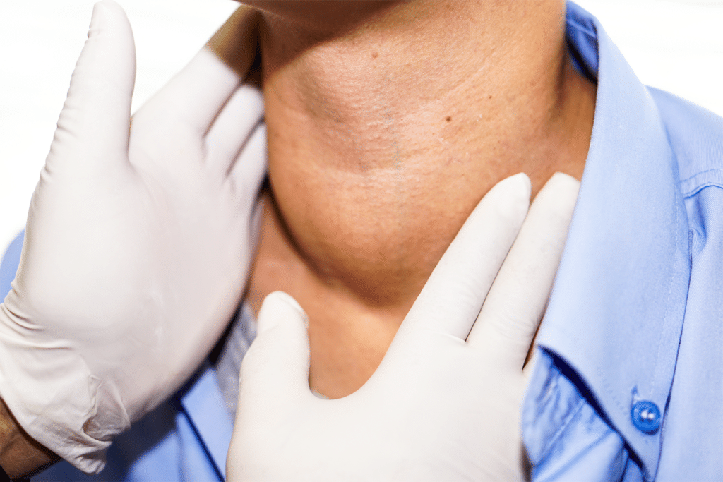 Penyakit Tiroid: Pengertian, Jenis Dan Penyebabnya